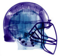 Concussion Detection